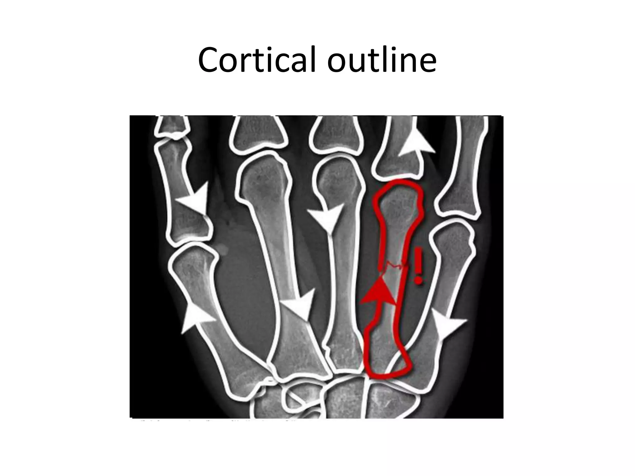Interpretation of musculoskeletal x rays | PPTX