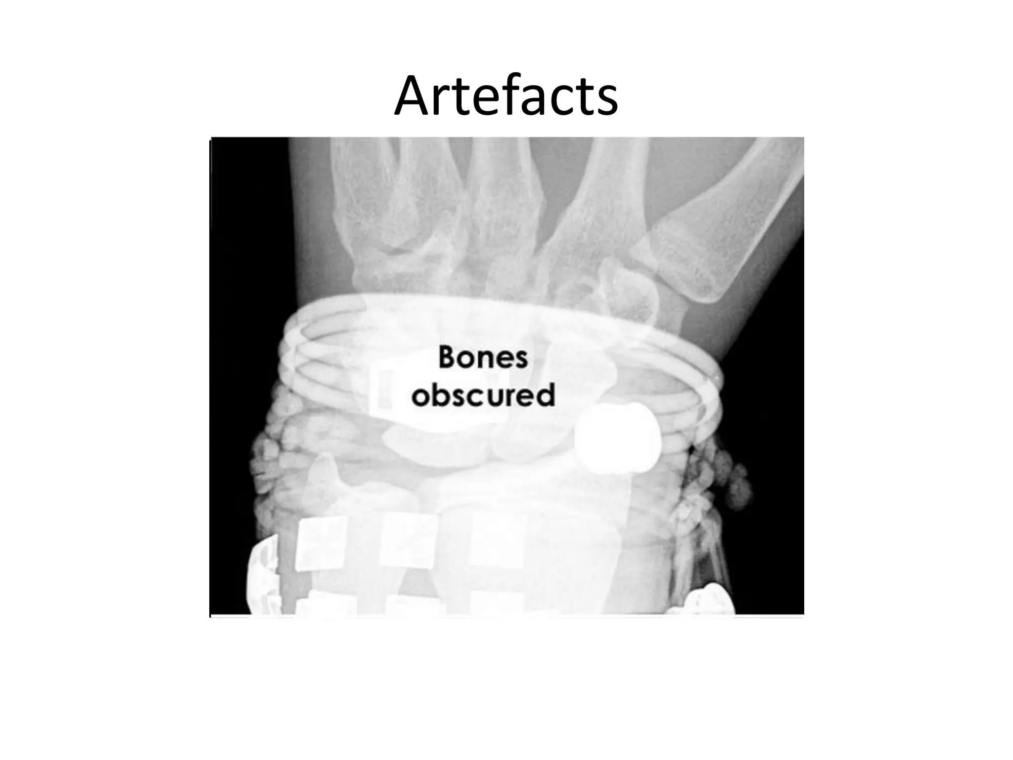 Interpretation of musculoskeletal x rays | PPTX