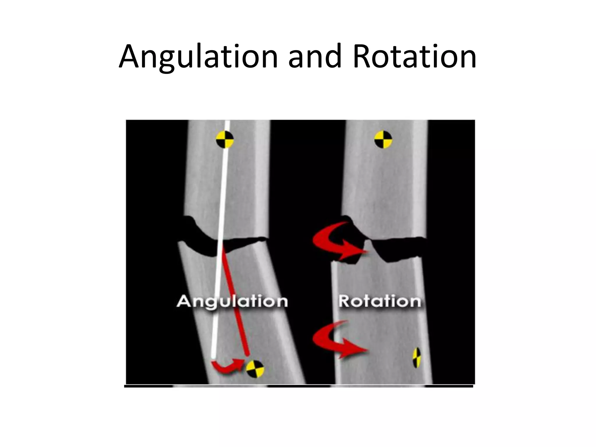 Interpretation of musculoskeletal x rays | PPTX