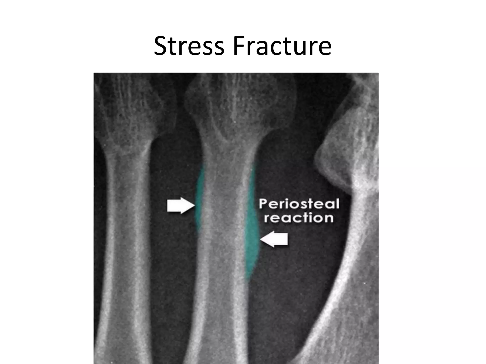 Interpretation of musculoskeletal x rays | PPTX