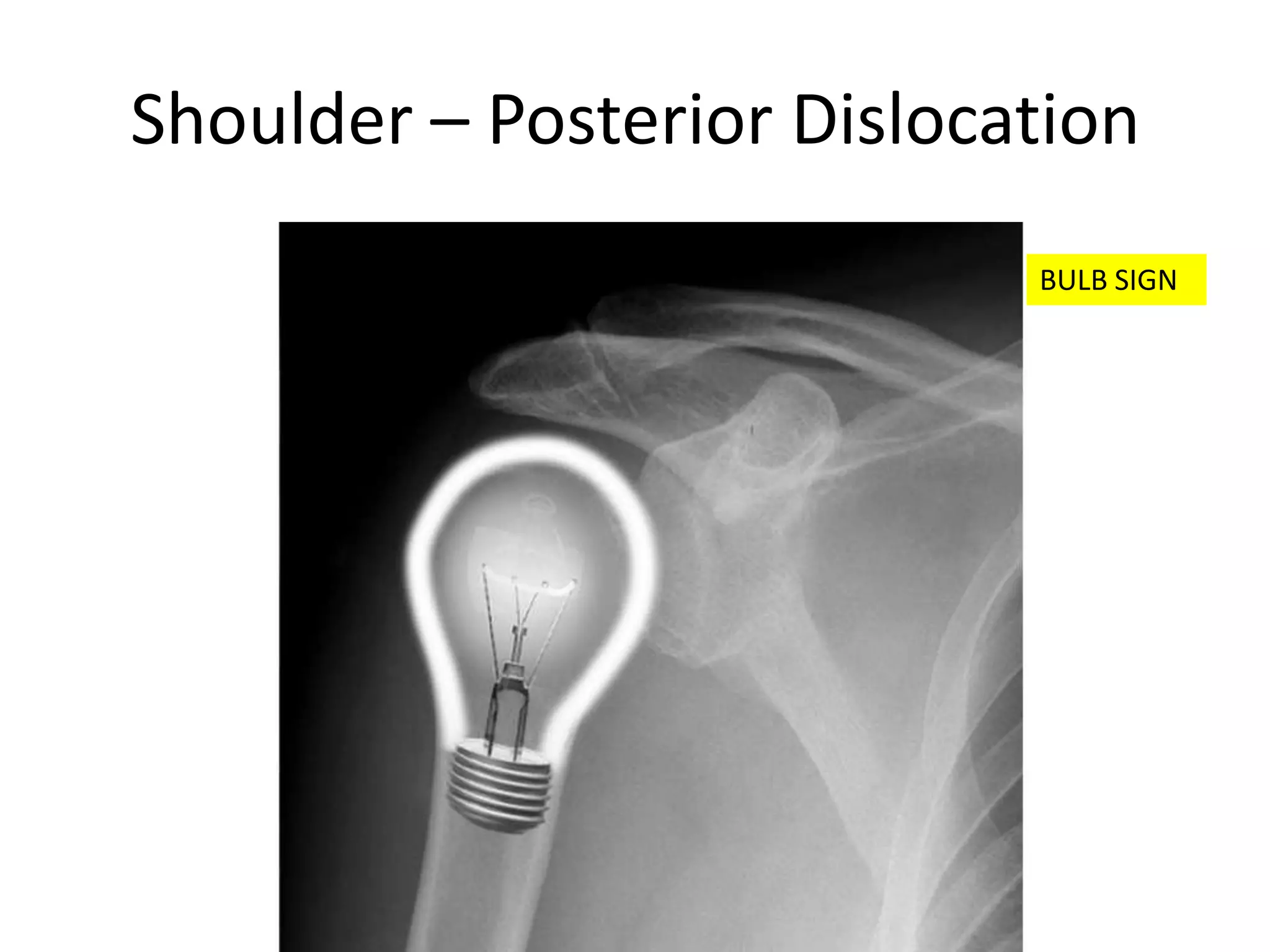 Interpretation of musculoskeletal x rays | PPTX