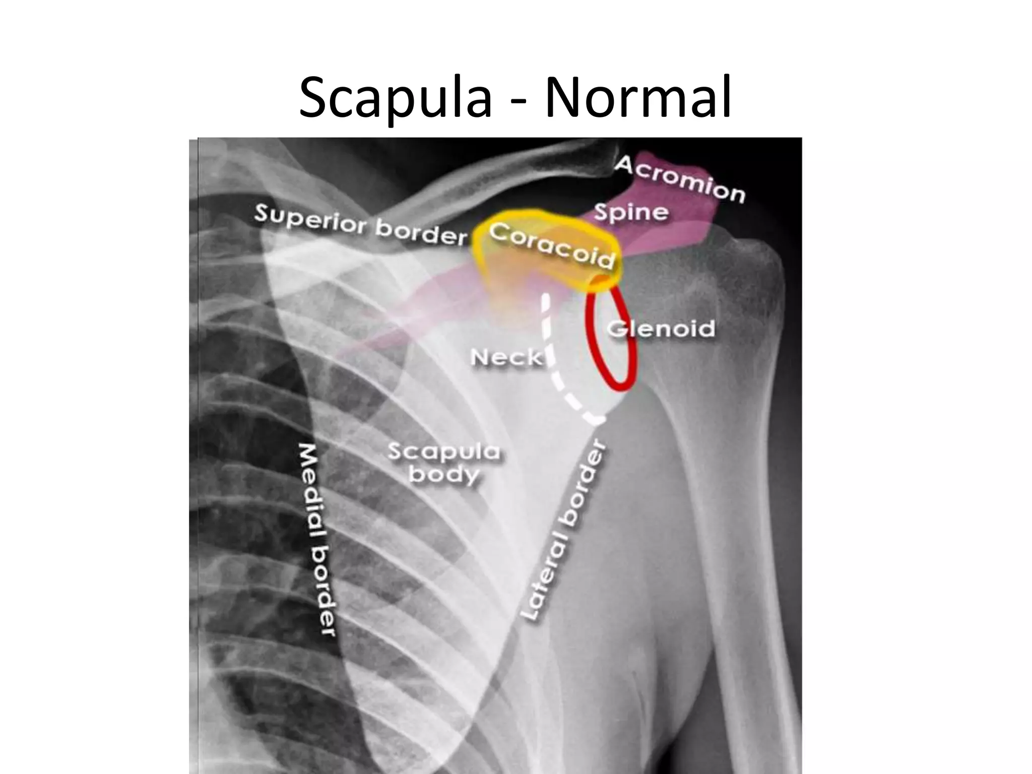 Interpretation of musculoskeletal x rays | PPTX