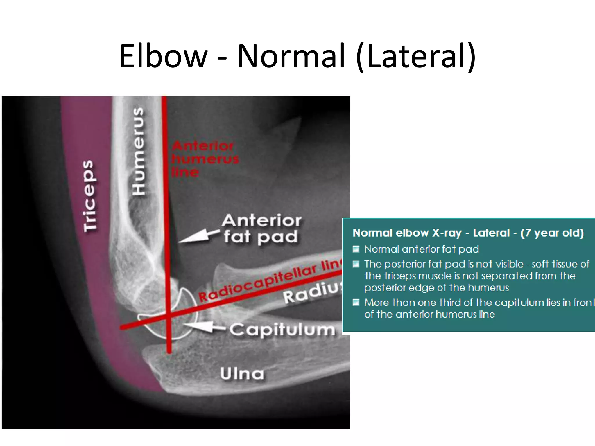 Interpretation of musculoskeletal x rays | PPTX
