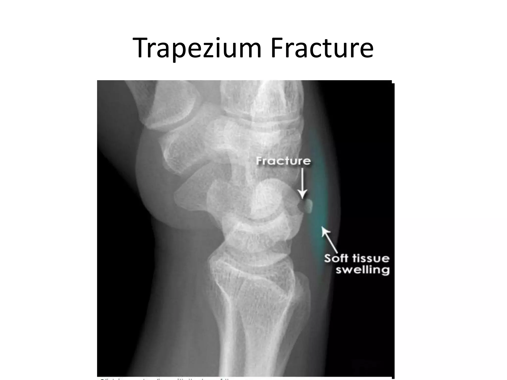 Interpretation of musculoskeletal x rays | PPTX