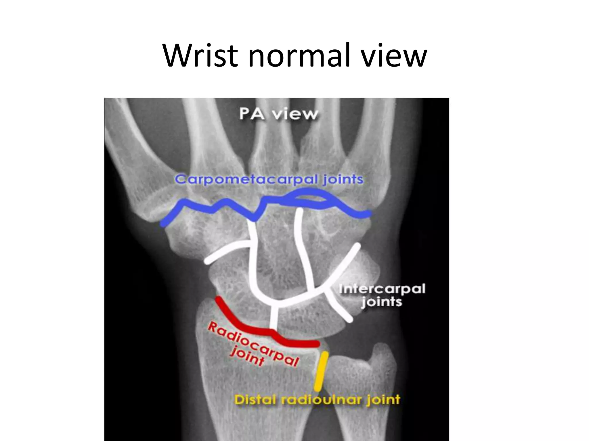 Interpretation of musculoskeletal x rays | PPTX