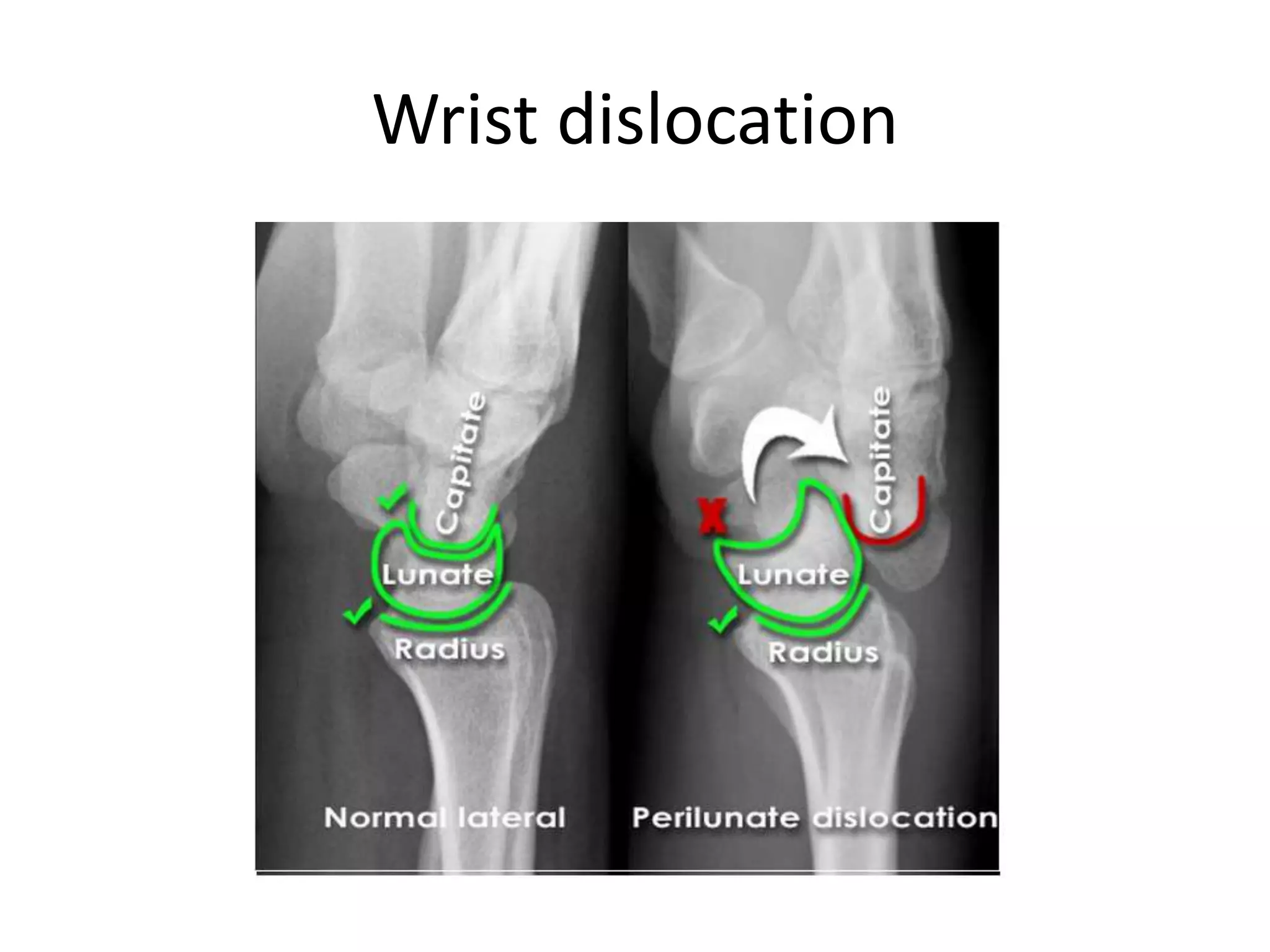 Interpretation of musculoskeletal x rays | PPTX