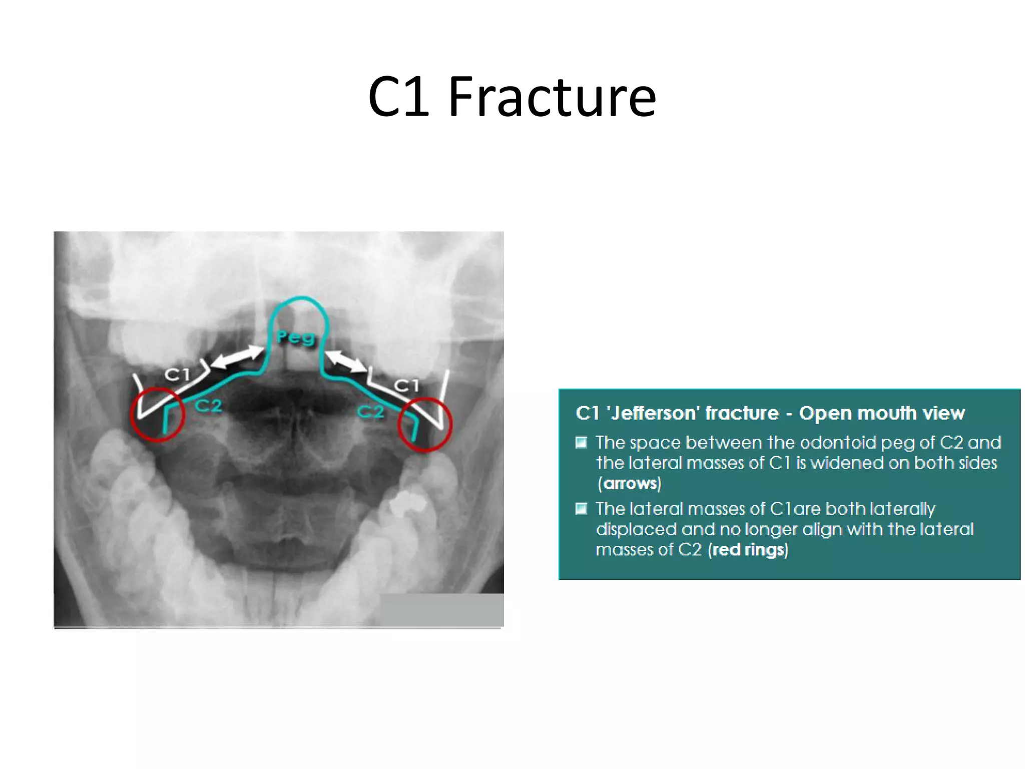 Interpretation of musculoskeletal x rays | PPTX