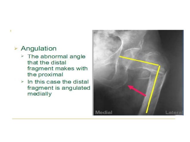 Interpretation of musculoskeletal x rays | PPTX