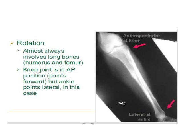 Interpretation of musculoskeletal x rays | PPTX