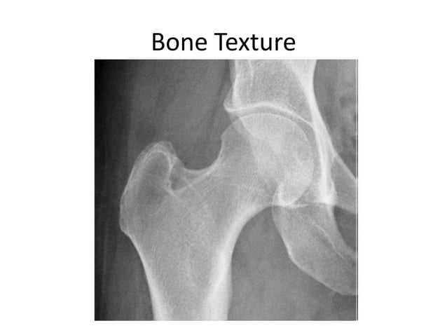 Interpretation of musculoskeletal x rays | PPTX