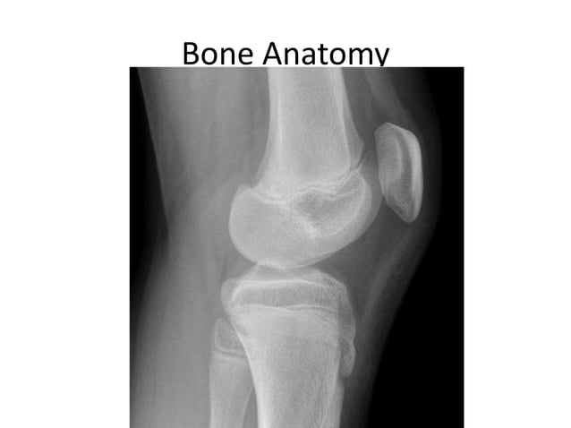 Interpretation of musculoskeletal x rays | PPTX