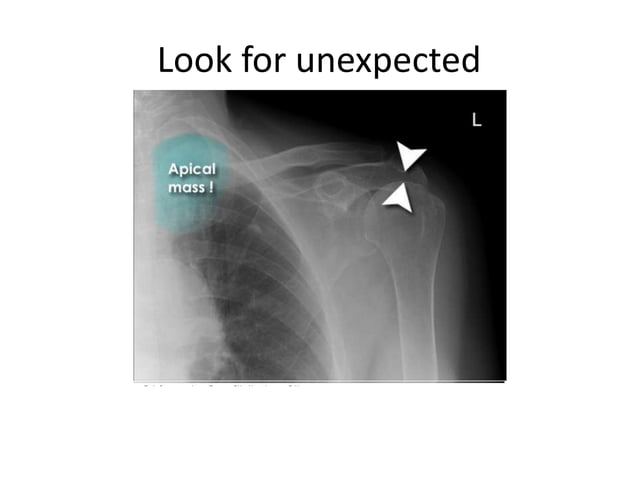 Interpretation of musculoskeletal x rays | PPTX