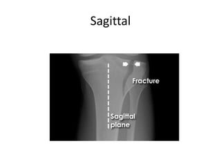 Interpretation of musculoskeletal x rays | PPTX