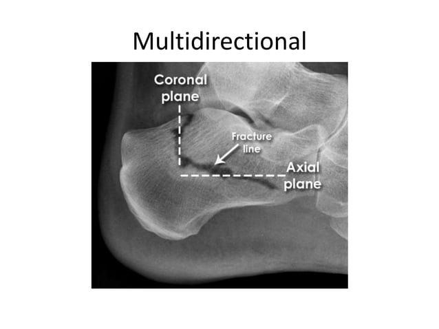 Interpretation of musculoskeletal x rays | PPTX