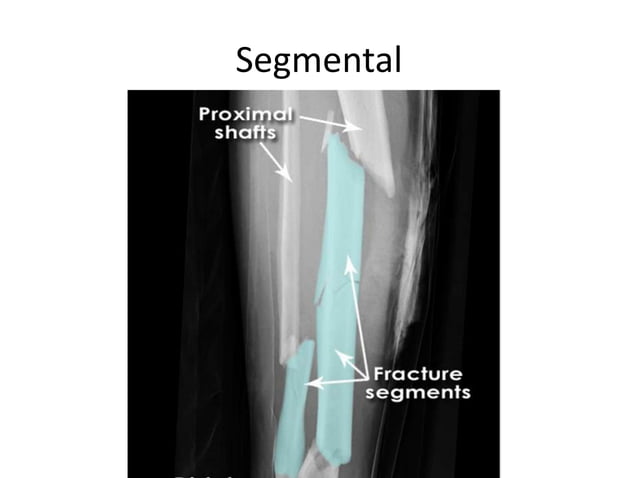 Interpretation of musculoskeletal x rays | PPTX