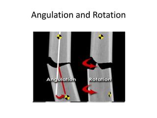 Interpretation of musculoskeletal x rays | PPTX