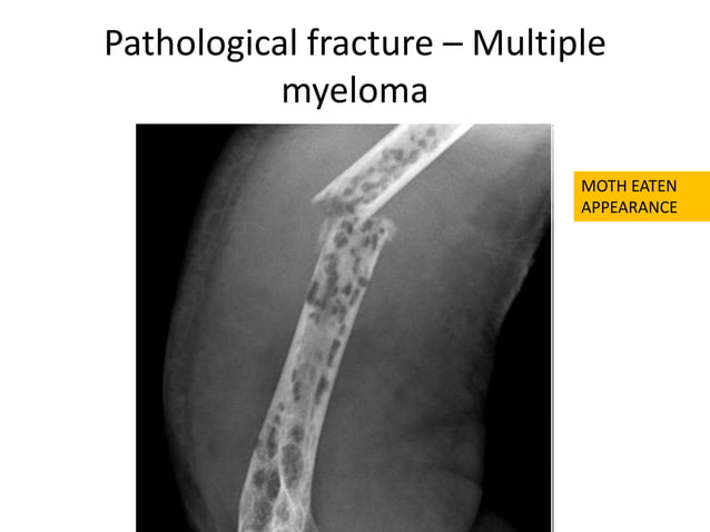 Interpretation of musculoskeletal x rays | PPTX