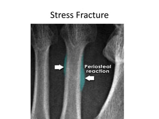 Interpretation of musculoskeletal x rays | PPTX