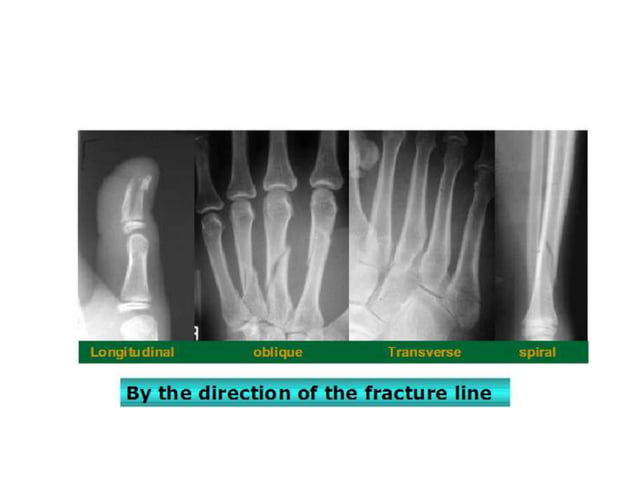 Interpretation of musculoskeletal x rays | PPTX
