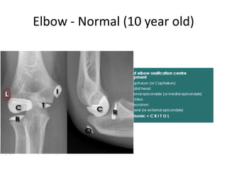 Interpretation of musculoskeletal x rays | PPTX