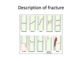 Interpretation of musculoskeletal x rays | PPTX