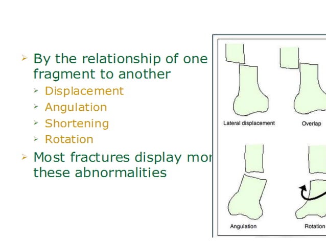 Interpretation of musculoskeletal x rays | PPTX