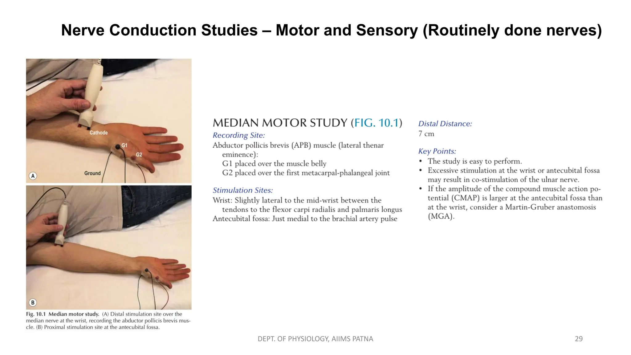 Interpretation of Nerve Conduction Study Findings | PDF