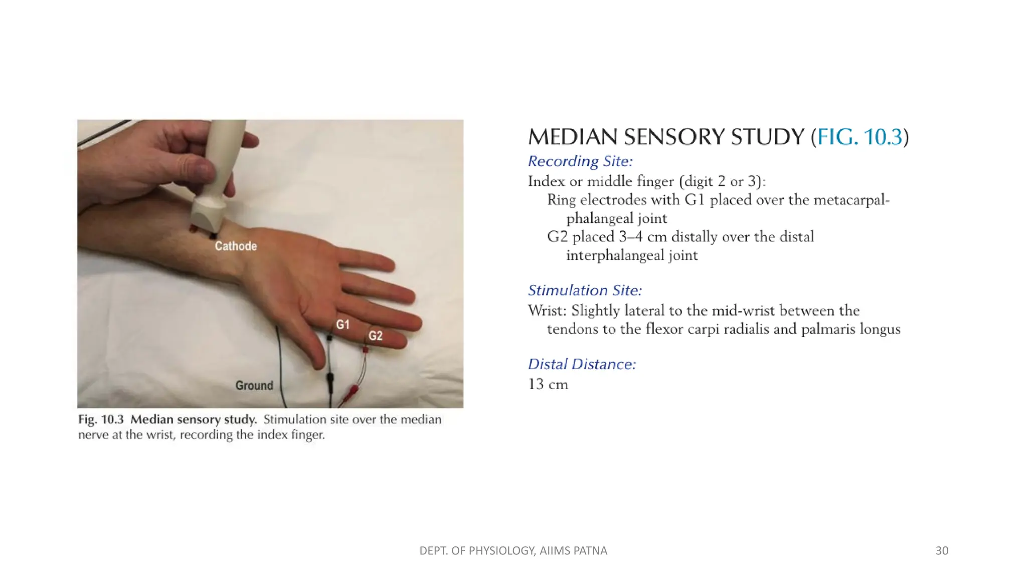 Interpretation of Nerve Conduction Study Findings | PDF