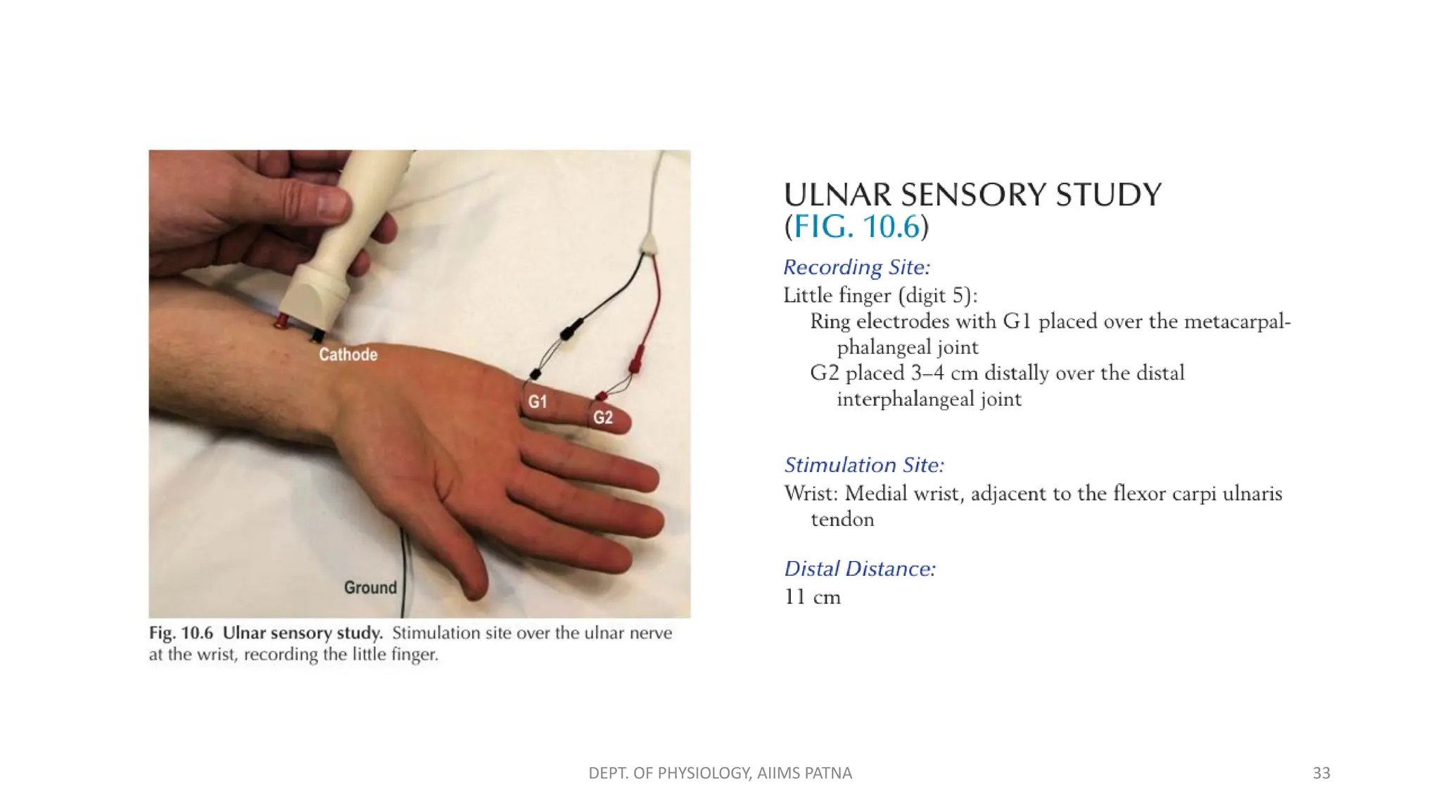 Interpretation of Nerve Conduction Study Findings | PDF