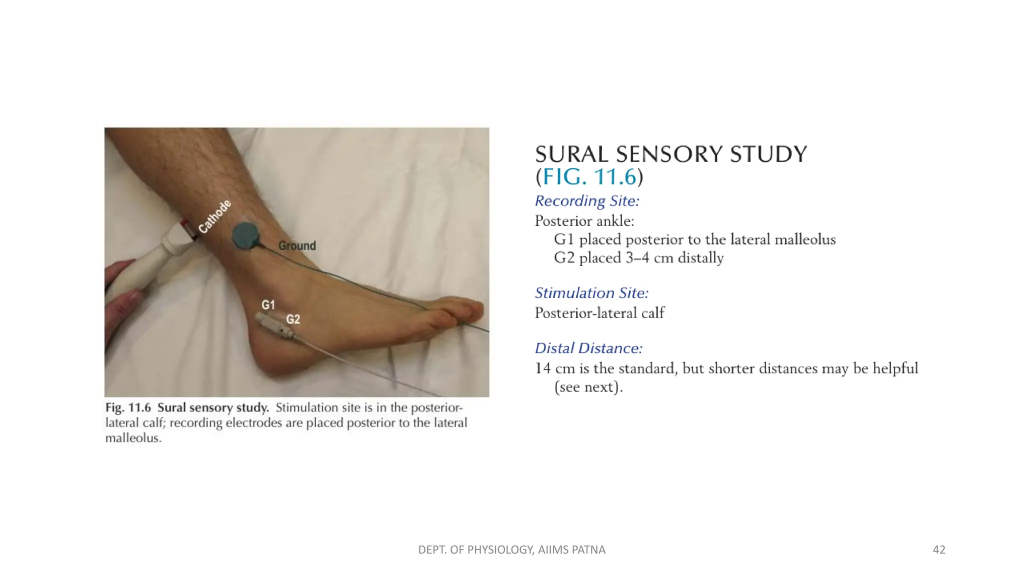 Interpretation of Nerve Conduction Study Findings | PDF