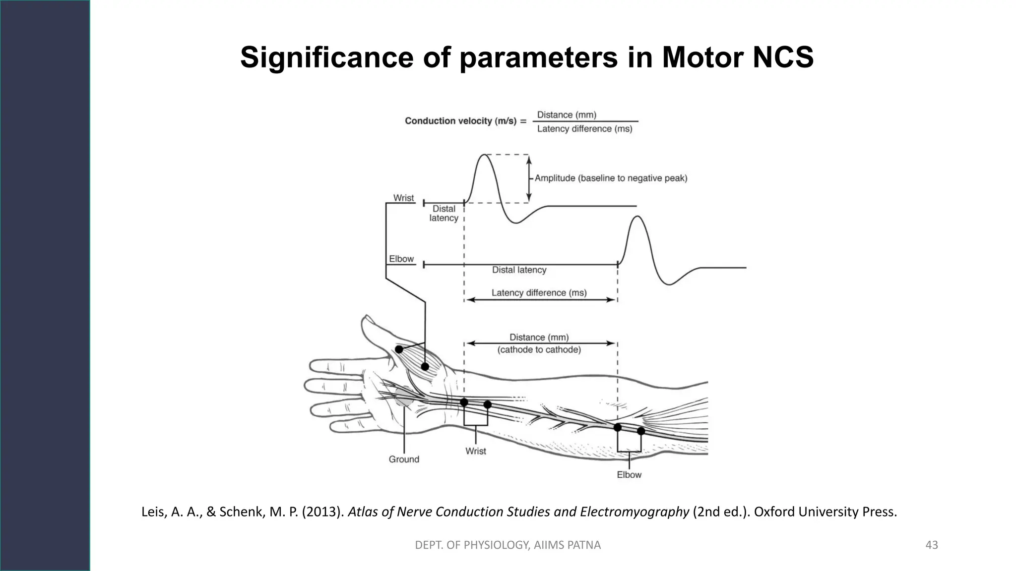 Interpretation of Nerve Conduction Study Findings | PDF