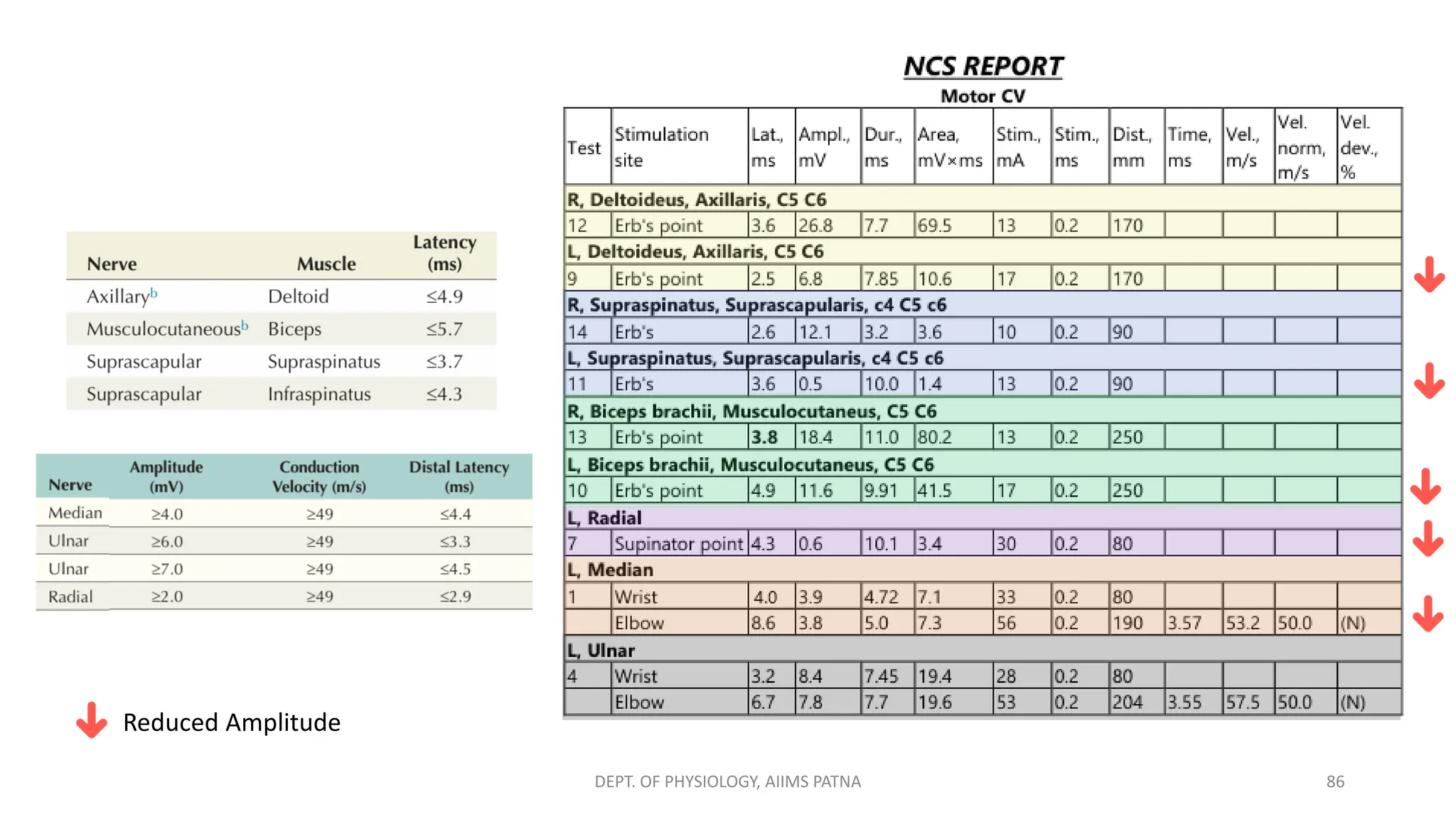 Interpretation of Nerve Conduction Study Findings | PDF