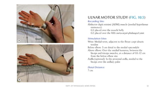 Interpretation of Nerve Conduction Study Findings | PDF
