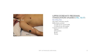 Interpretation of Nerve Conduction Study Findings | PDF