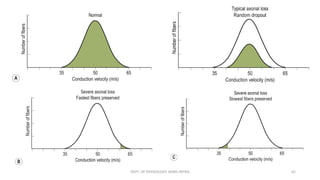 Interpretation of Nerve Conduction Study Findings | PDF