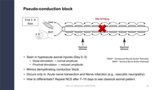Interpretation of Nerve Conduction Study Findings | PDF