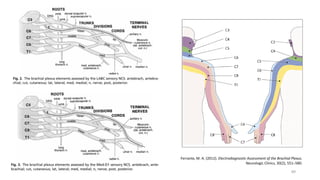 Interpretation of Nerve Conduction Study Findings | PDF