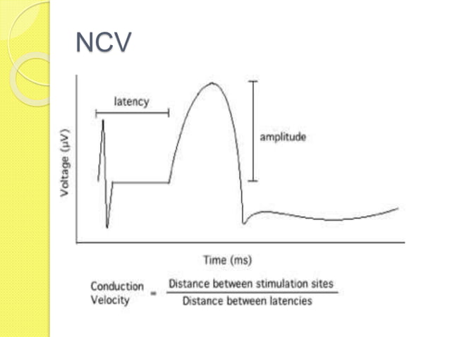 Interpretation of NCV.pptx | Brain and Nervous System Disorders ...