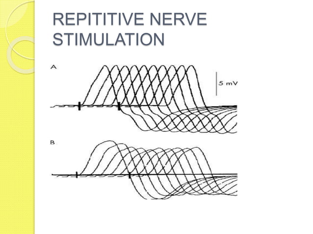 Interpretation of NCV.pptx | Brain and Nervous System Disorders ...