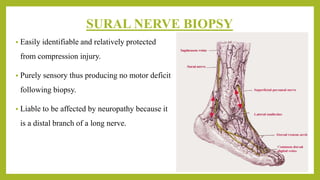 Sural Nerve Biopsy