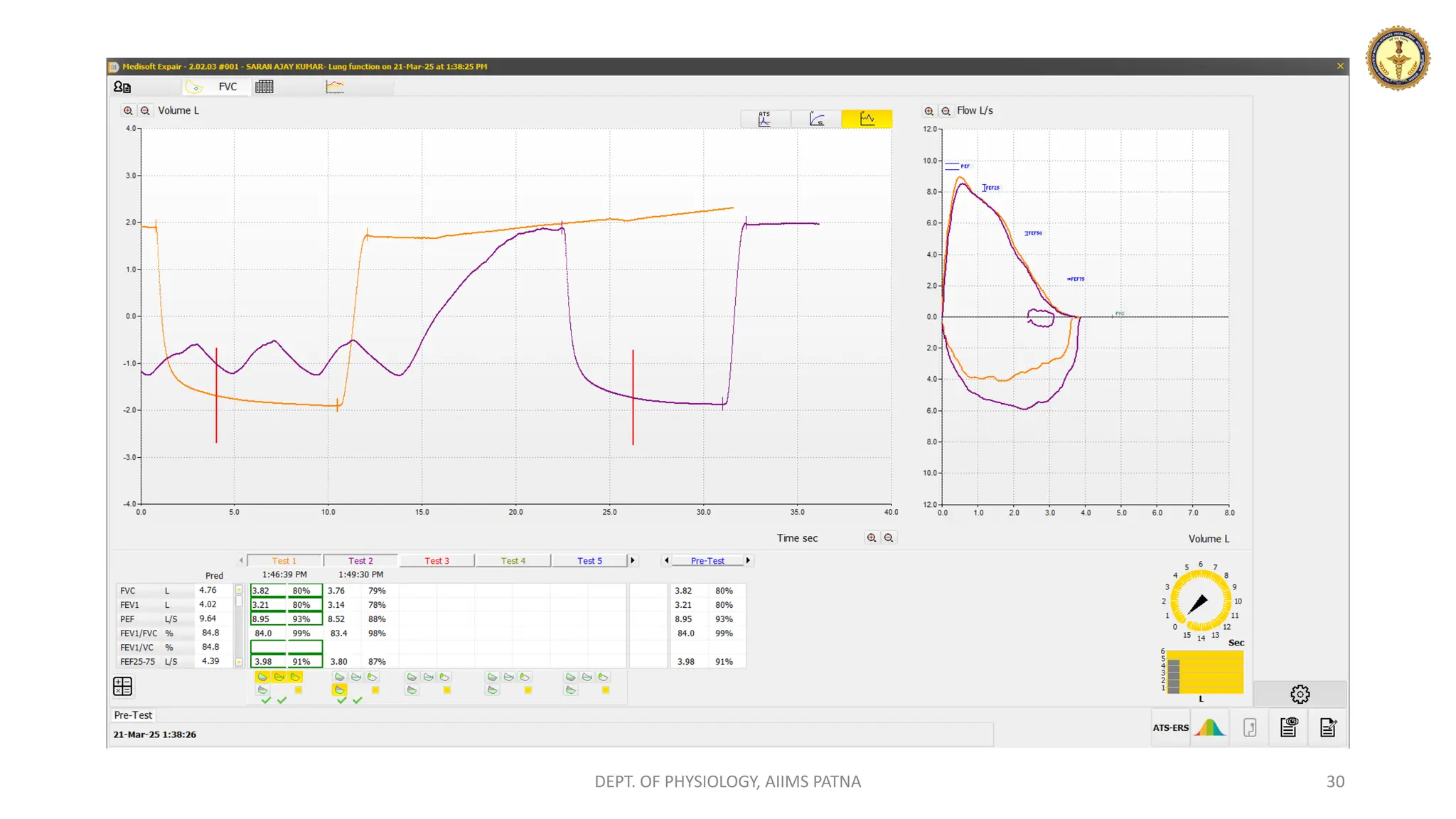 Interpretation of Cardiopulmonary Exercise Testing - Nine Panel Plots | PDF