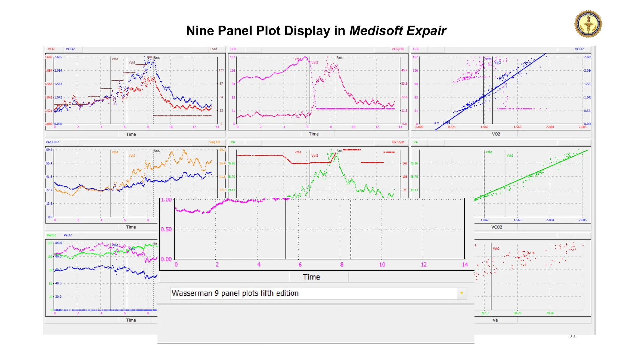 Interpretation of Cardiopulmonary Exercise Testing - Nine Panel Plots | PDF