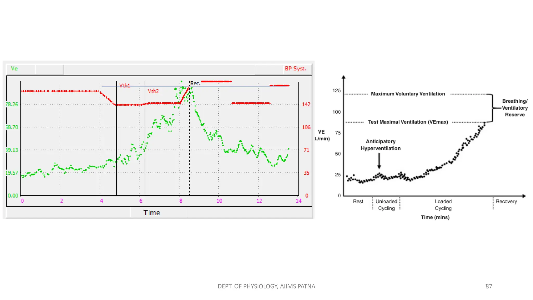 Interpretation of Cardiopulmonary Exercise Testing - Nine Panel Plots | PDF