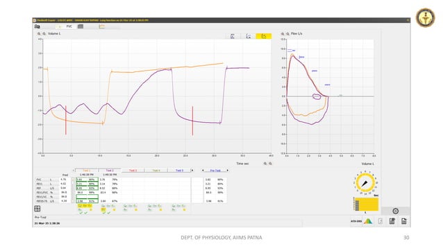 Interpretation of Cardiopulmonary Exercise Testing - Nine Panel Plots | PDF