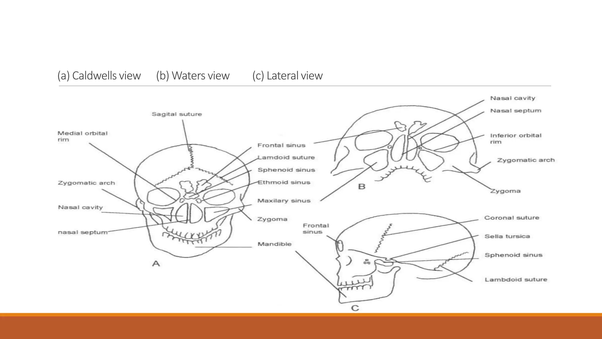 Interpretation of normal radiograph | PPTX