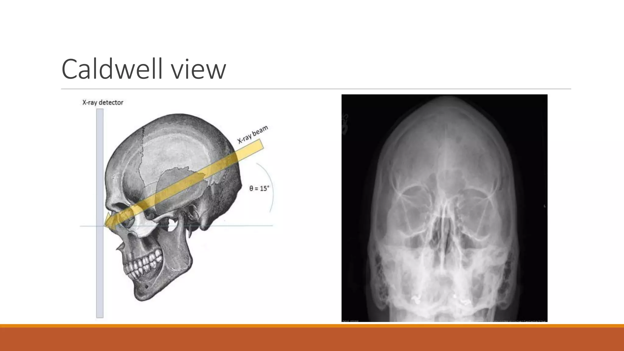 Interpretation of normal radiograph | PPTX