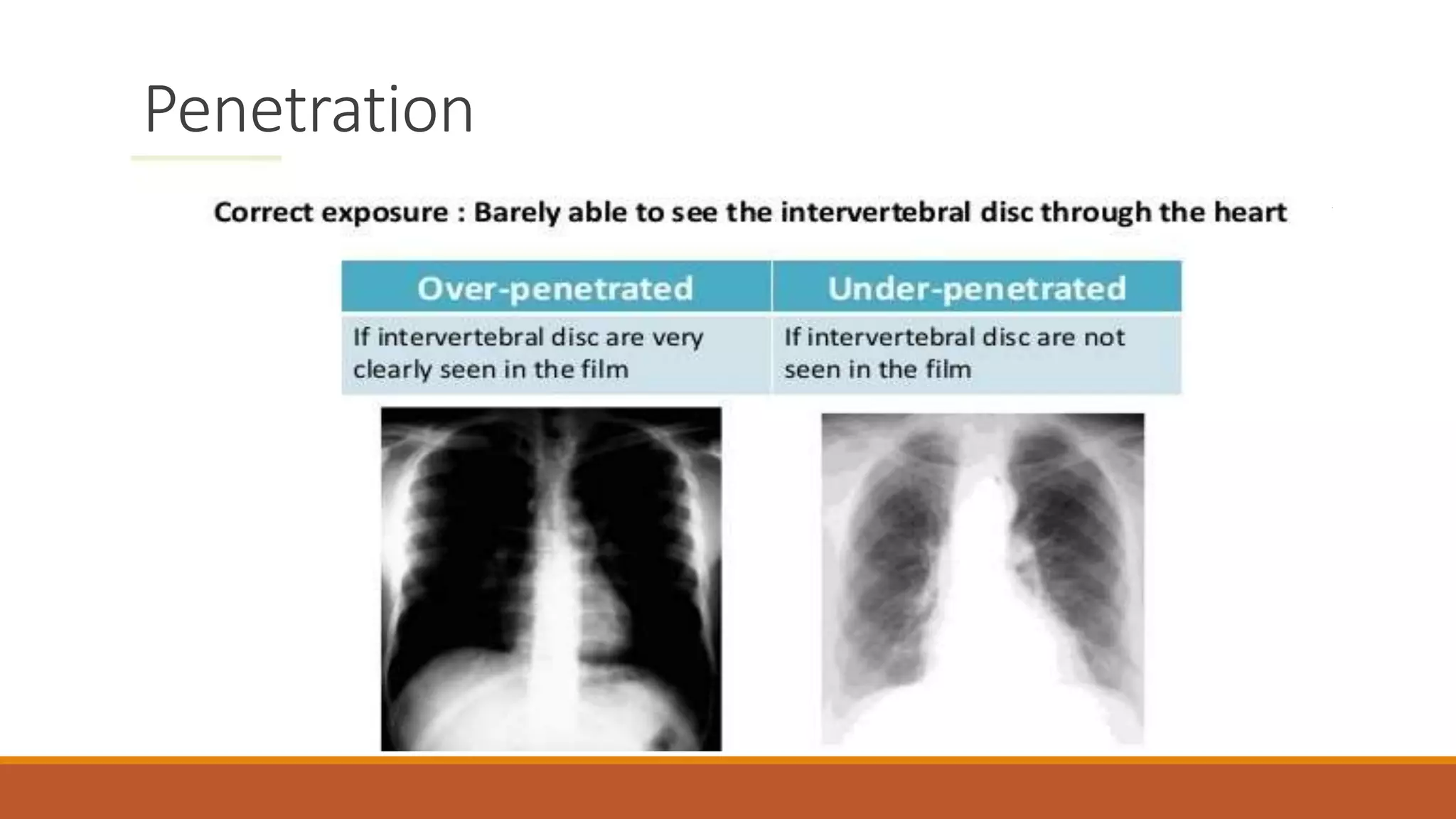 Interpretation of normal radiograph | PPTX | Death, Injury, or Military ...
