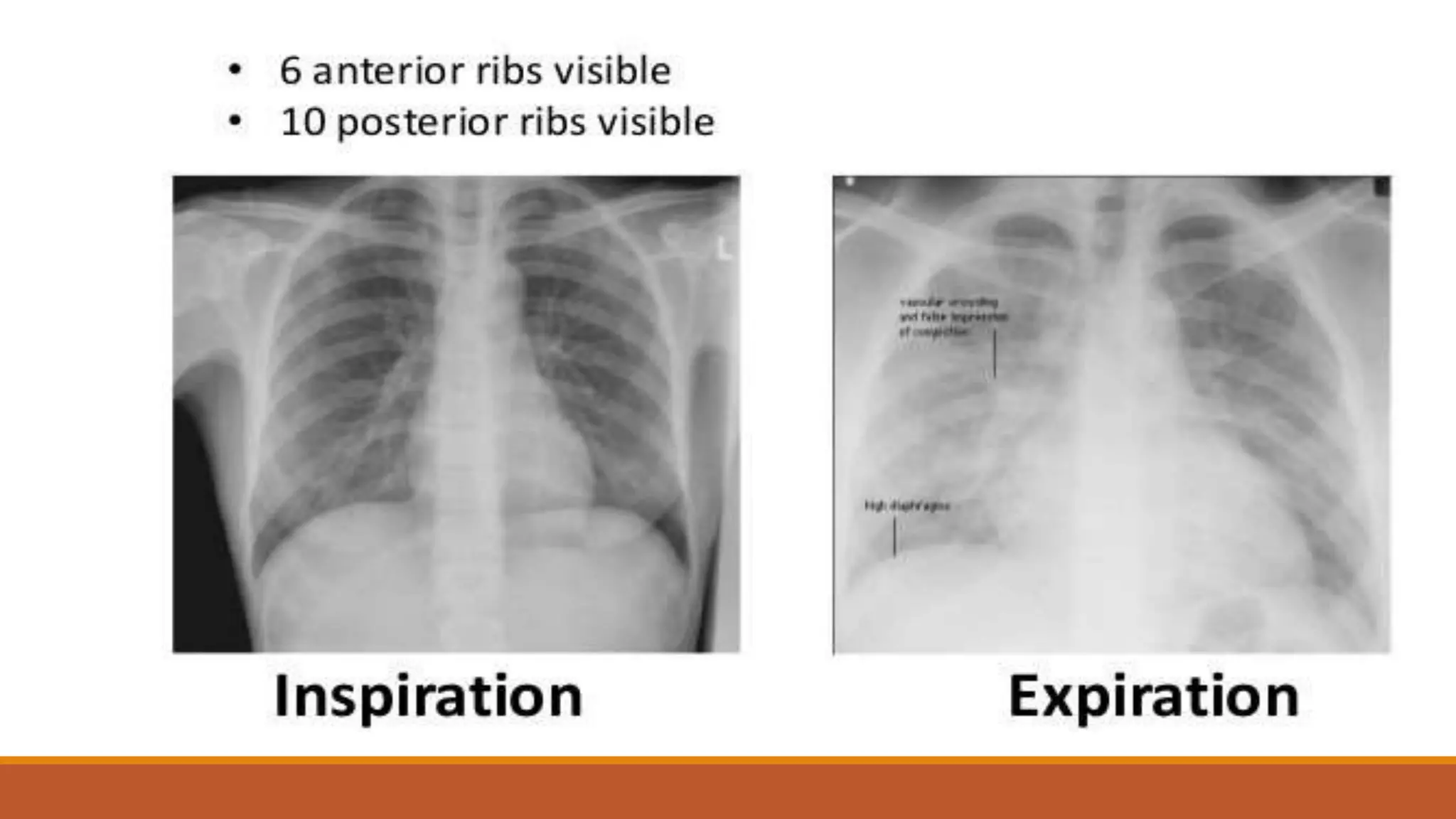 Interpretation of normal radiograph | PPTX