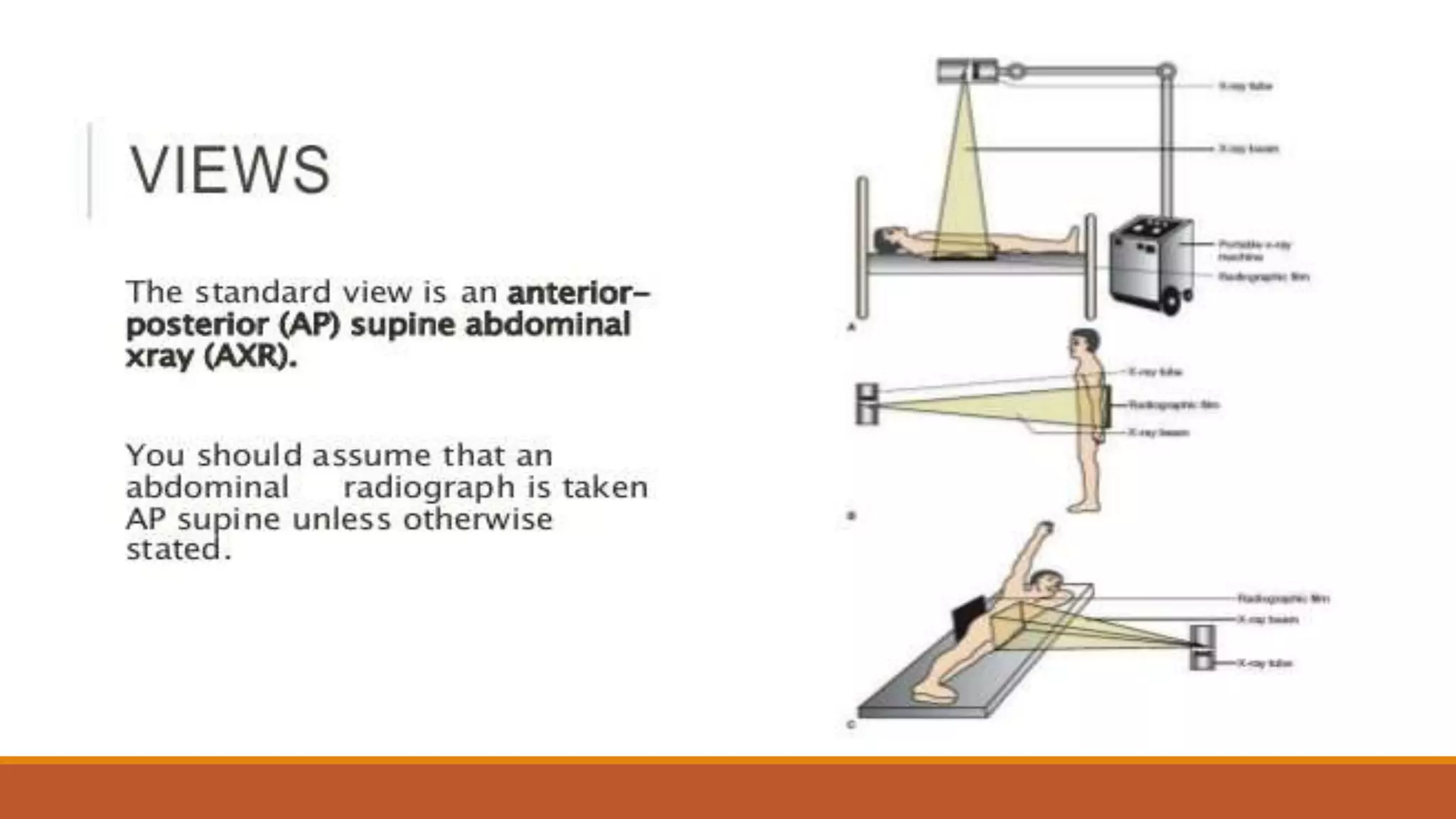 Interpretation of normal radiograph | PPTX