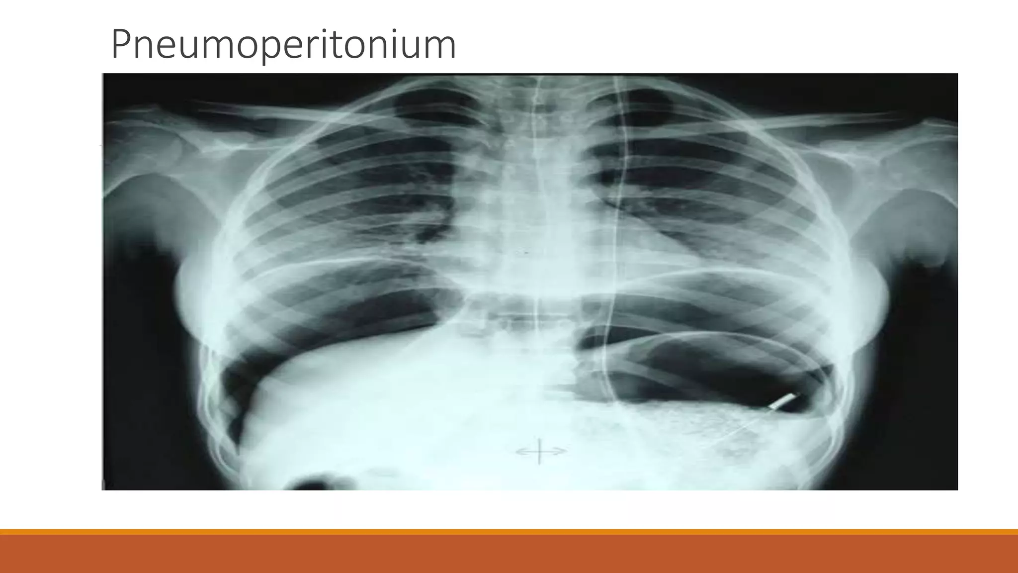 Interpretation of normal radiograph | PPTX